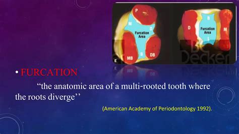 Furcation Involvement And Management Pptx