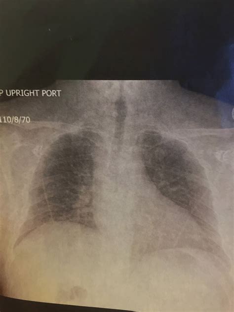 X Ray Album On Imgur X Ray Album On Imgur