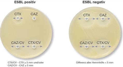Esbl Kit D76c 4x 50 Bl Mast Md100893