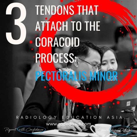 Biceps Tendon Dislocation Radiology Mri Video Radiology Education Asia