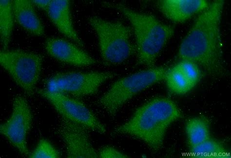 Ppp3ca Antibody 68163 1 Ig Proteintech