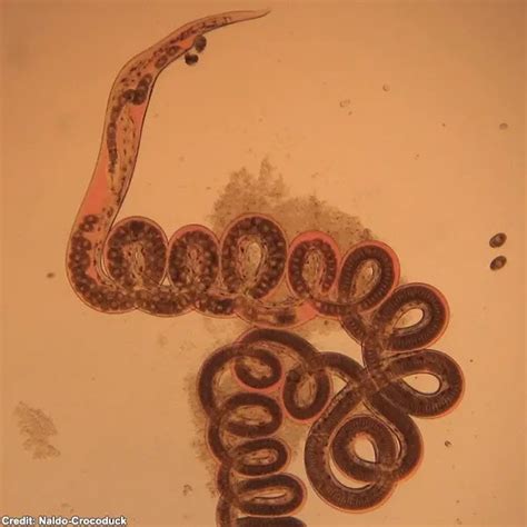 Parasitic Intestinal Roundworm Heligmosomoides Polygyrus Makes Your