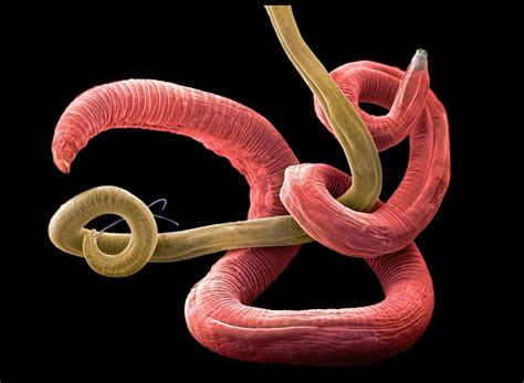 A Female Roundworm Coils Around A Male Whose Two Needle Like Mating