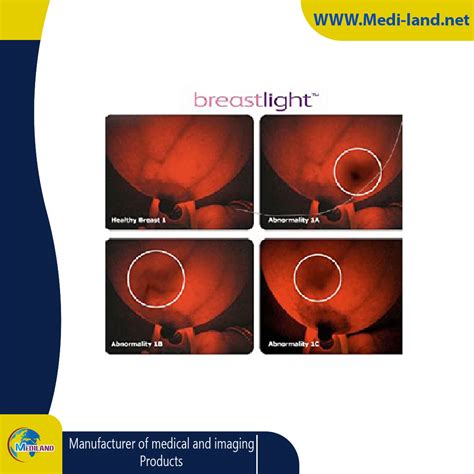 breast light breast screening device medi land