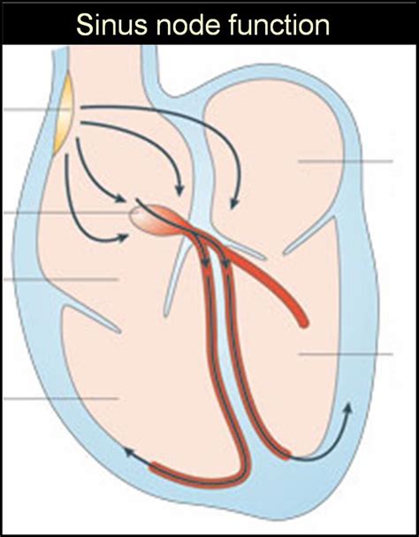 What Is Sinus Pause Dr S Venkatesan Md