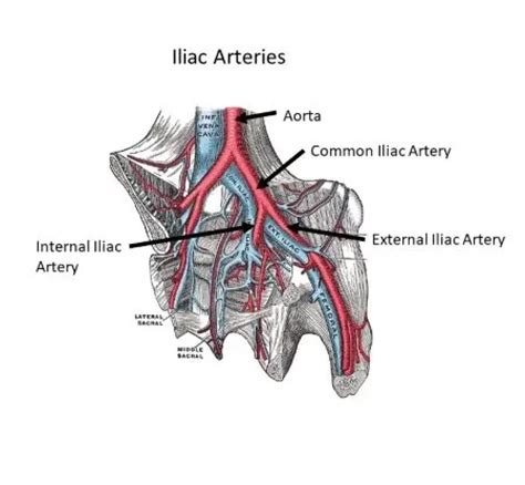 Iliac Artery Iliac Artery An Overview Sciencedirect Topics