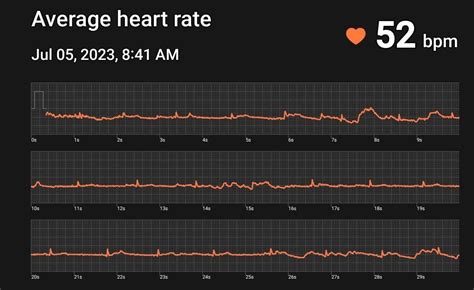 Echo Low Hr Diastolic Dysfunction Grade 1 And Afib R Askcardiology