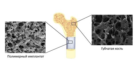 Iron Polymer Russian Ultra High Molecular Weight Polyethylene