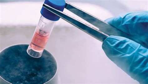 Stem Cells Featured Decisions In Dentistry