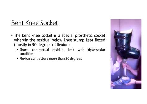 Lower Extremity Prostheses Pdf