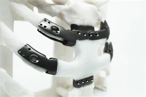 Anatomics Delivers First 3d Printed Sternum Implant In America