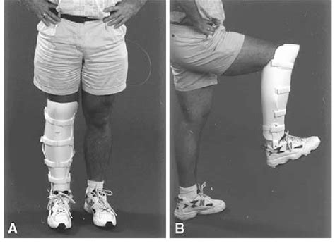 A B A A Photograph Of A Functional Brace Shows Full Flexion Of The