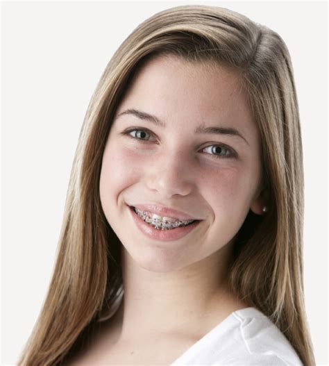 Braces And Orthodontics The Art Of Dentistry