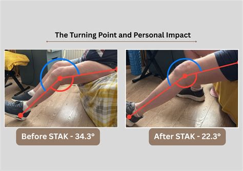How To Measure Knee Flexion At Home Simple Steps Stak Knee Stretcher