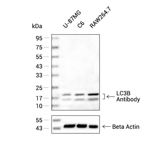 Lc3b Antibody Medchemexpress