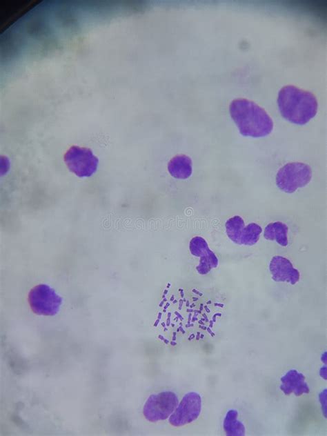 Human Chromosomes Under The Microscope Stock Image Image Of Pattern Pink 381986297