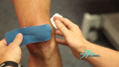 Knee Taping