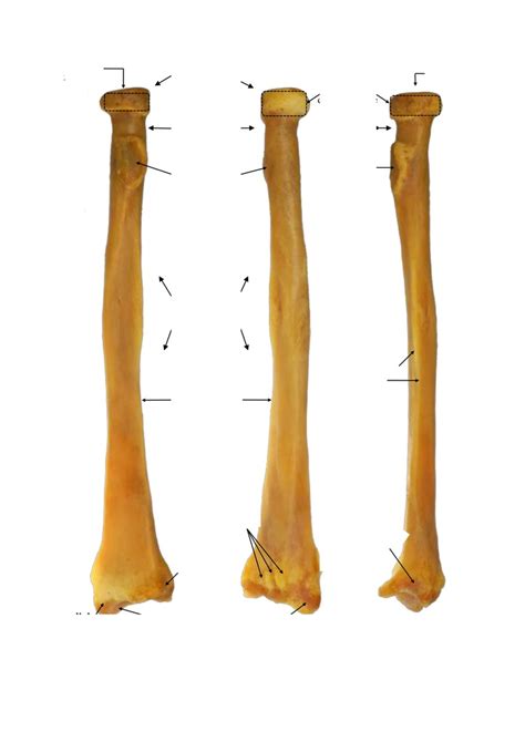 Radius Diagram Quizlet
