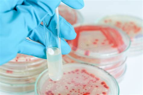 Microbiology Laboratory Test Stock Image Image Of Chemical