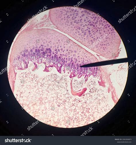 Endochondral Ossification Slide