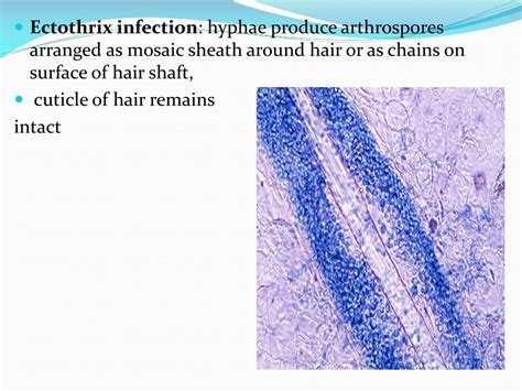 Ppt Superficial Mycoses Powerpoint Presentation Free Download Id