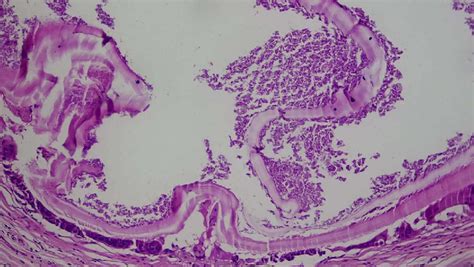 Medium Power Microscopic Examination Demonstrating Germinative Layer Download Scientific