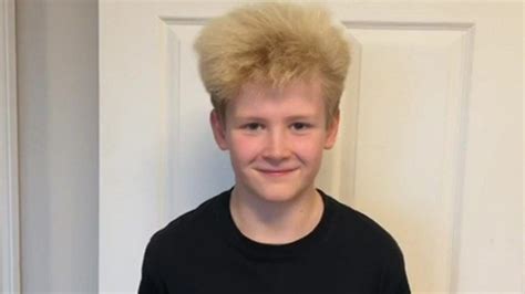 Uncombable Hair Syndrome Sam Tells His Story Bbc Newsround
