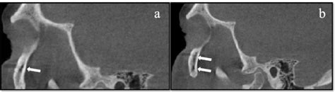 Unilocular A And Multilocular B Zbp Arrows Download Scientific