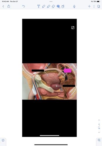 Lab Practical Flashcards Quizlet Lab Practical Flashcards Quizlet