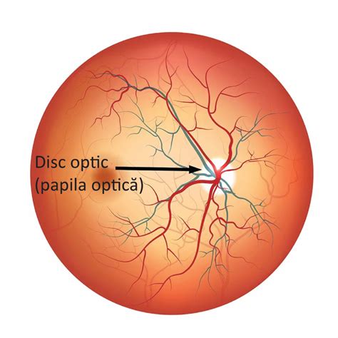 Optic Disc Optic Papilla Vitreum Ophthalmology Clinic