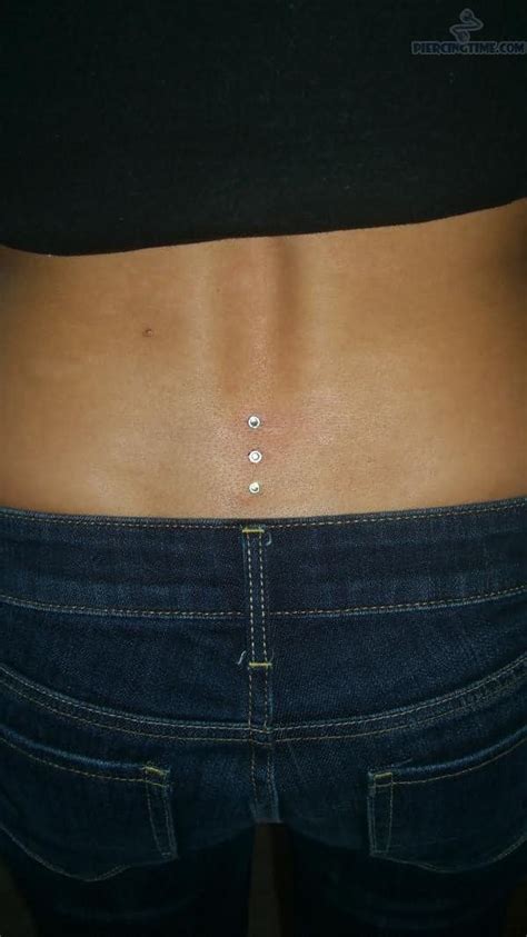 Back Dermal Piercing Scars