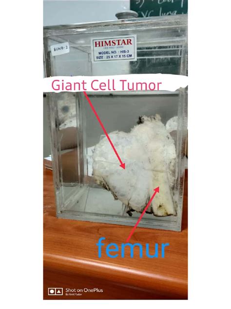 Pathology Specimen Pdf