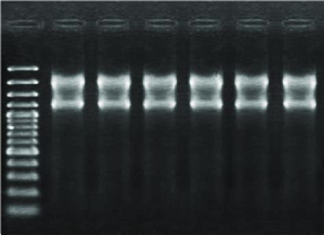 Samples Of The Extracted Rna Download Scientific Diagram