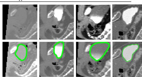 Figure 1 1 From Segmentation Of Anatomical Structures Of The Lower