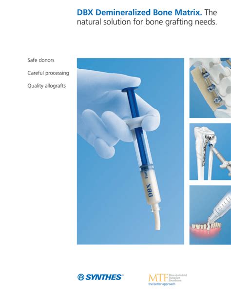 Dbx Demineralized Bone Matrix Grafting Solution Synthes