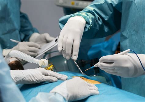 A Step By Step Guide To Laparoscopic Procedures