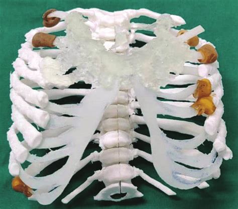 Costal Cartilage