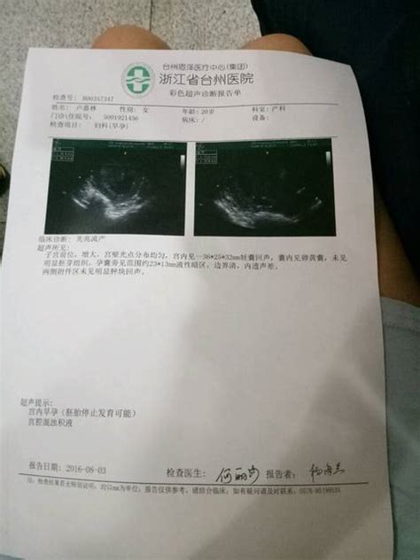 胎儿发育不好如何引产 胎儿心脏不好 个月引产 随意云