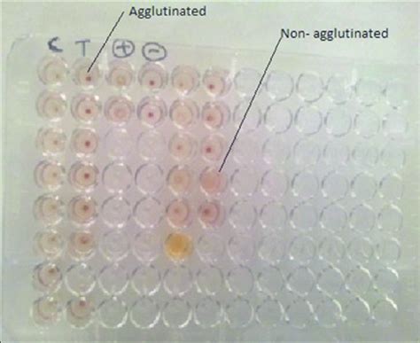 Treponema Pallidum Haemagglutination Assay C Control Cells T Test