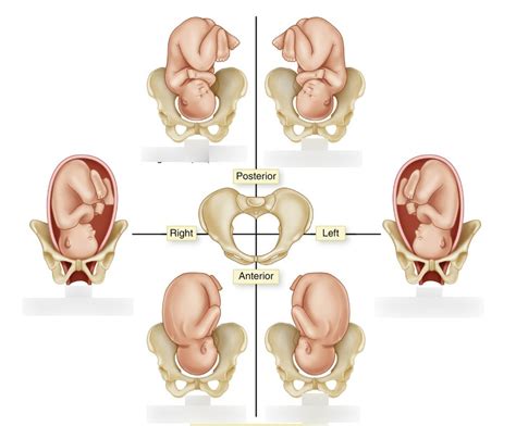 Variedade De Posição Fetal Retoedu