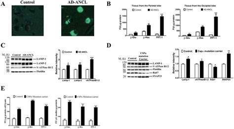 Lysosome Dysfunction In Ad Ancl In Vivo And In Vitro A Download