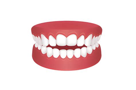 Class 3 Malocclusions Vs Other Bite Issues