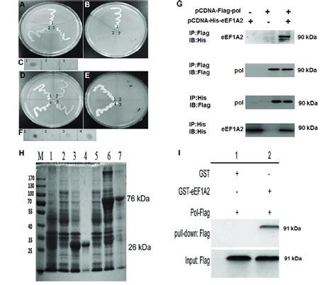 A Yeast Two Hybrid Analysis Of In Vitro Interaction Between Hbv Pol And Download Scientific