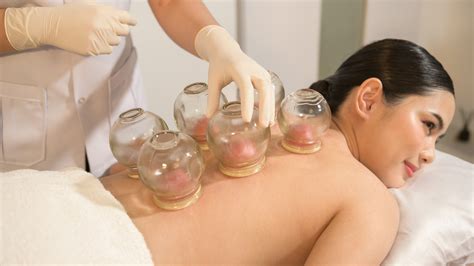 Cupping Therapy Do Your Patients Really Need It Bte