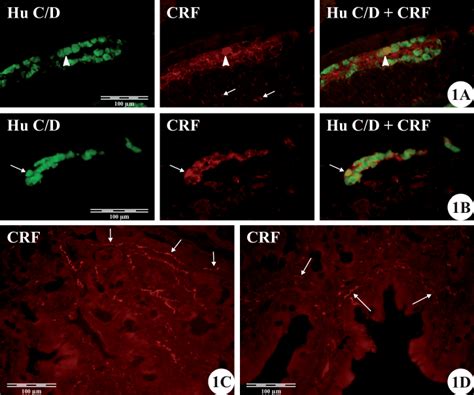 Fluorescence Micrographs Showing The Expression Of Crf In The Ens Of