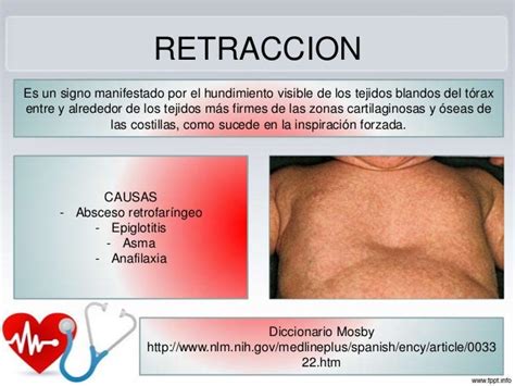 Caso Cardio Respiratorio