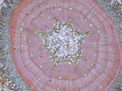 1012 Plants Valley Microscope