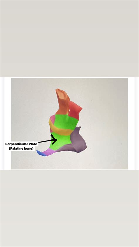 Solved Select The Perpendicular Plate Course Hero