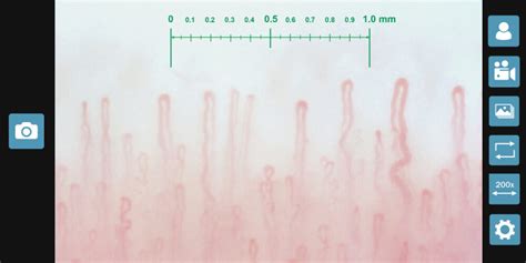 Digiscope Wi Fi Capillaroscopy System Capillaroscopy