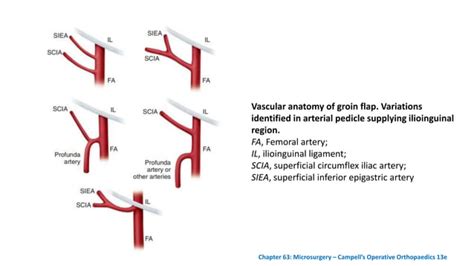 Thumb Soft Tissue Defects Ppt